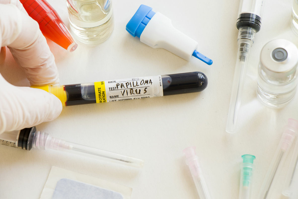 Everything You Need to Know About Human Papillomavirus - HelloHealth ...